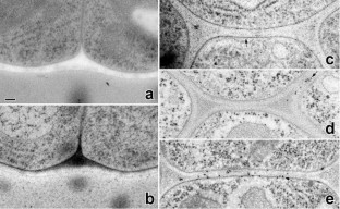 Late type of daughter cell wall synthesis in one of the Chlorellaceae ...