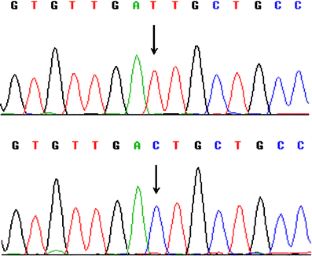 Ligneous conjunctivitis: a clinicopathological, immunohistochemical ...