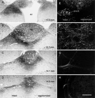 Vanilloid receptor (VR1) expression in vagal afferent neurons ...