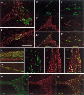 Vanilloid receptor (VR1) expression in vagal afferent neurons ...