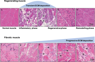 Skeletal muscle fibrosis: an overview | SpringerLink