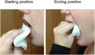 A Pilot Study of the Tongue Pull-Back Exercise for Improving Tongue ...