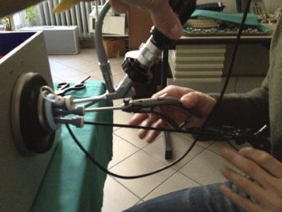 TransAnal Minimally Invasive Surgery (TAMIS) with SILS™ Port versus ...