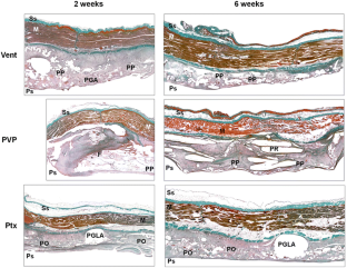 Intraperitoneal behaviour of a new composite mesh (Parietex™ Composite ...