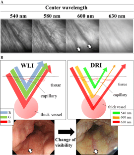 Dual red imaging (novel advanced endoscopy) can increase visibility and ...