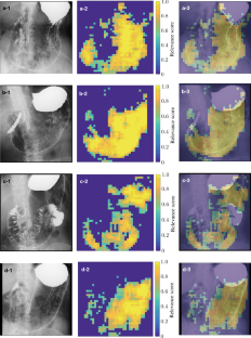 Detection of gastritis by a deep convolutional neural network from ...