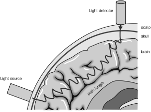 Guidelines for the use of cerebral oximetry by near-infrared spectroscopy in cardiovascular ...
