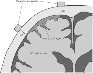 Guidelines for the use of cerebral oximetry by near-infrared ...