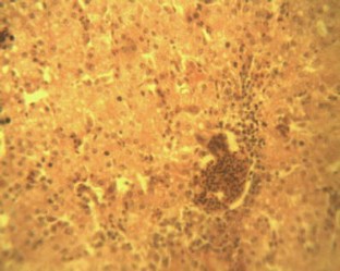 Observations on an outbreak of fowl typhoid in commercial laying birds ...