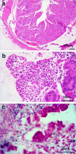 Pathological and biochemical studies on enterotoxemia in sheep ...