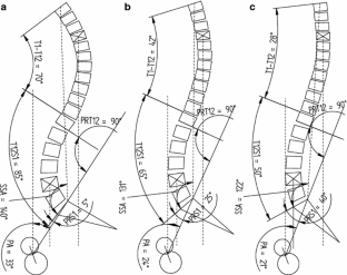 Lumbo-pelvic lordosis and the pelvic radius technique in the assessment ...