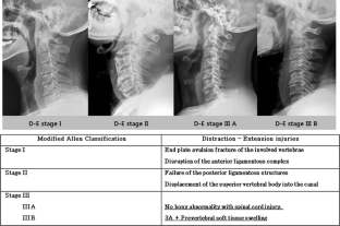 Limitation of previous Allen classification and subaxial cervical spine ...