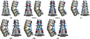 Supplementary delta-rod configurations provide superior stiffness and ...