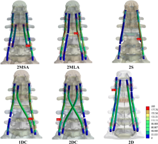 Supplementary delta-rod configurations provide superior stiffness and ...