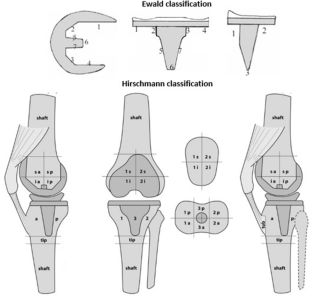 Bone scan usefulness in patients with painful hip or knee prosthesis ...