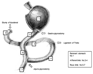 Migrating contractions of the afferent and Roux limbs show peristaltic ...