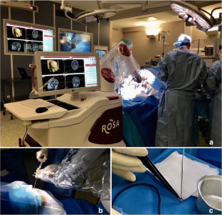 Stereotactic brain biopsy: evaluation of robot-assisted procedure in 60 ...