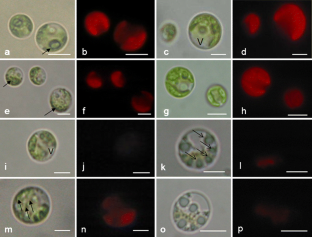 Morphophysiological analyses of Neochloris oleoabundans (Chlorophyta ...