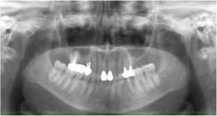 Can four-dimensional computed tomography support diagnosis and ...