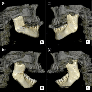 Can four-dimensional computed tomography support diagnosis and ...