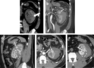The American Association for the Surgery of Trauma Organ Injury Scale ...