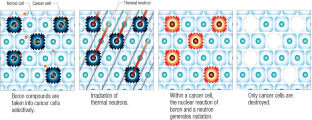 Boron neutron capture therapy (BNCT): a unique role in radiotherapy ...