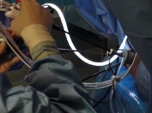 Robotic transanal minimally invasive surgery in a cadaveric model ...