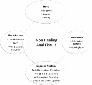Pathogenesis and persistence of cryptoglandular anal fistula: a ...