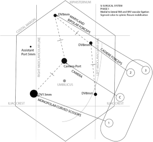 Robotic low anterior resection: how to maximise success in difficult ...