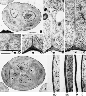 Regeneration and maturation of daughter cell walls in the autospore ...