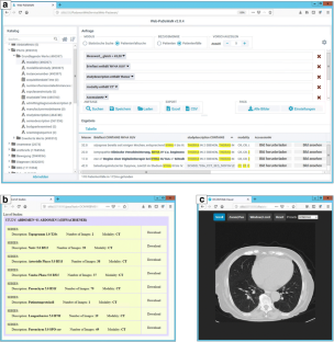 Unlocking the PACS DICOM Domain for its Use in Clinical Research Data Warehouses | SpringerLink