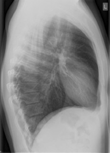 Röntgenuntersuchung des Thorax | SpringerLink