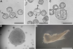 Influence of the stage for anther excision and heterostyly in ...