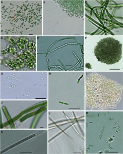 Cyanobacterial community and microcystin production in a recreational ...