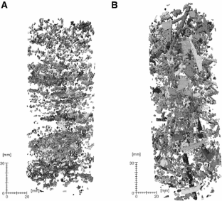 A three-dimensional classification for mathematical pore shape description in complex carbonate ...