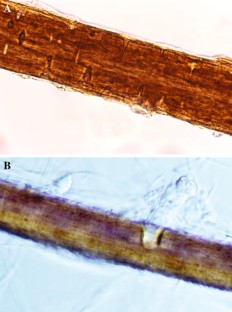 Conventional Methods for the Diagnosis of Dermatophytosis | SpringerLink