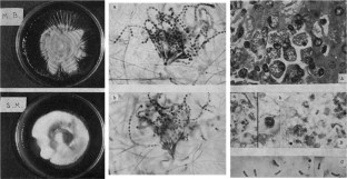 Talaromycosis (Penicilliosis) Due to Talaromyces ( Penicillium ...