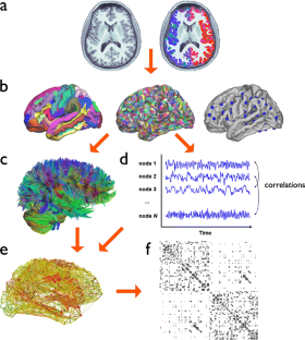 Brain Networks in Schizophrenia | SpringerLink
