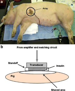 Ultrasound Mediated Transdermal Insulin Delivery in Pigs Using a ...