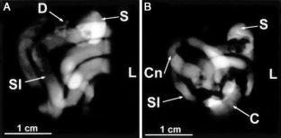 Liquid Perfluorocarbons as Contrast Agents for Ultrasonography and 19 F ...