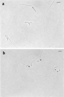 Ultrastructural study of spermatogenesis in KSR2 deficient mice | SpringerLink