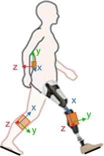 Gait event detection using inertial measurement units in people with transfemoral amputation: a ...