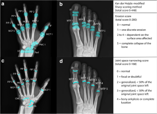 Radiographic scoring methods in rheumatoid arthritis and psoriatic ...