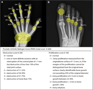Radiographic scoring methods in rheumatoid arthritis and psoriatic ...