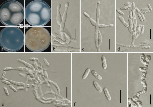 Phylogenetic analysis of Plectosphaerella species based on multi-locus ...