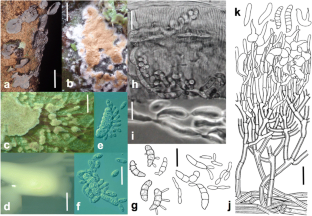 Yeasts in Pucciniomycotina | SpringerLink