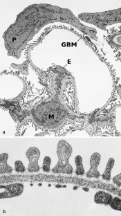 Biologie des Podozyten | SpringerLink