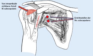 Arthroskopische Rekonstruktion der Subscapularissehne | SpringerLink