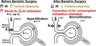 Renal Hyperfiltration in Adolescents with Type 2 Diabetes: Physiology ...