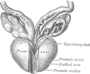 Ejaculatory Duct Obstruction: Current Diagnosis and Treatment | SpringerLink